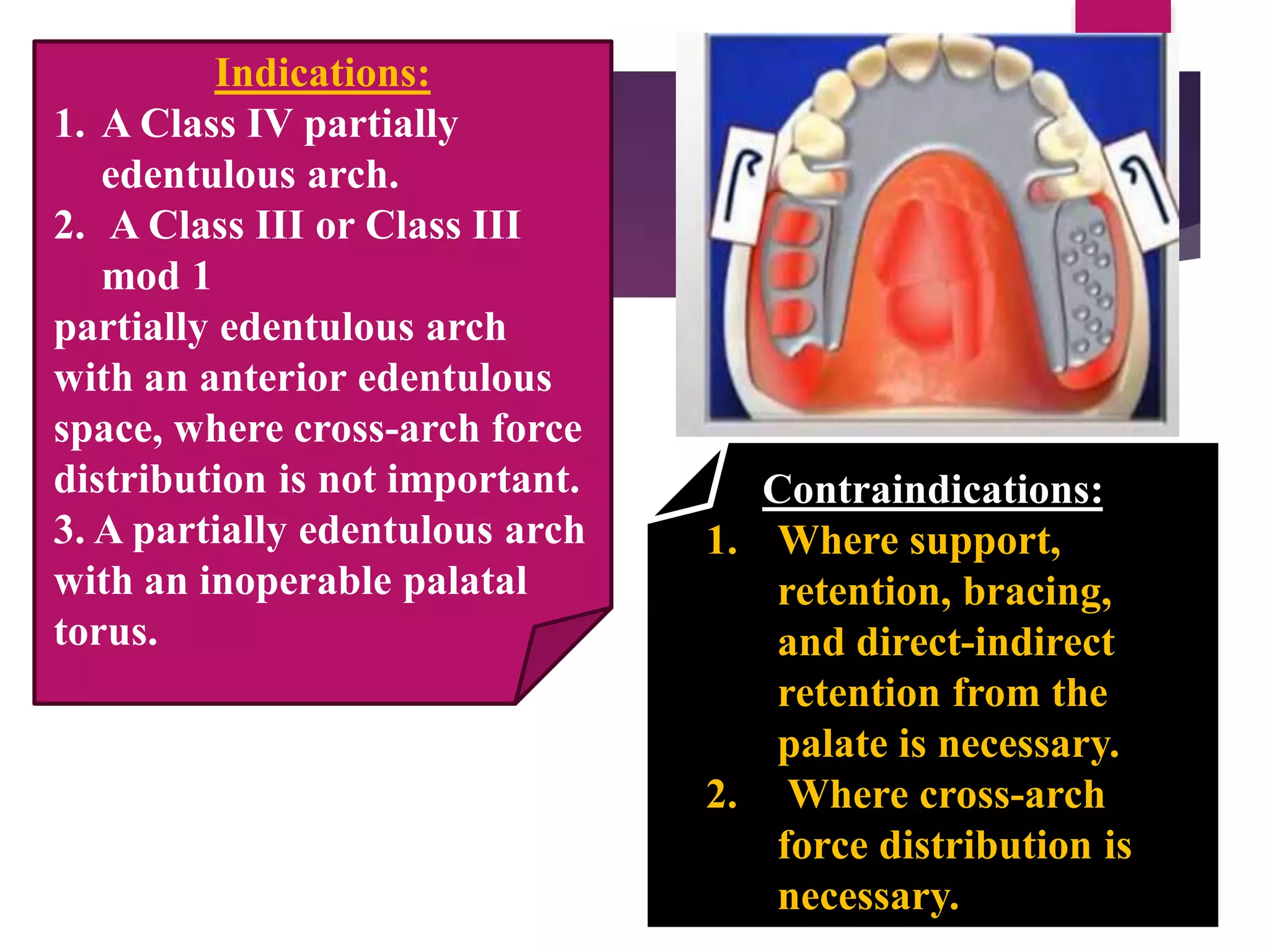 Maxillary & Mandibular Major Connectors.pptx