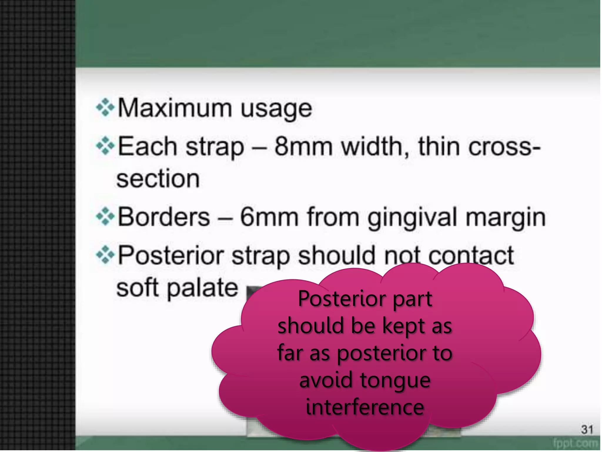 Maxillary & Mandibular Major Connectors.pptx