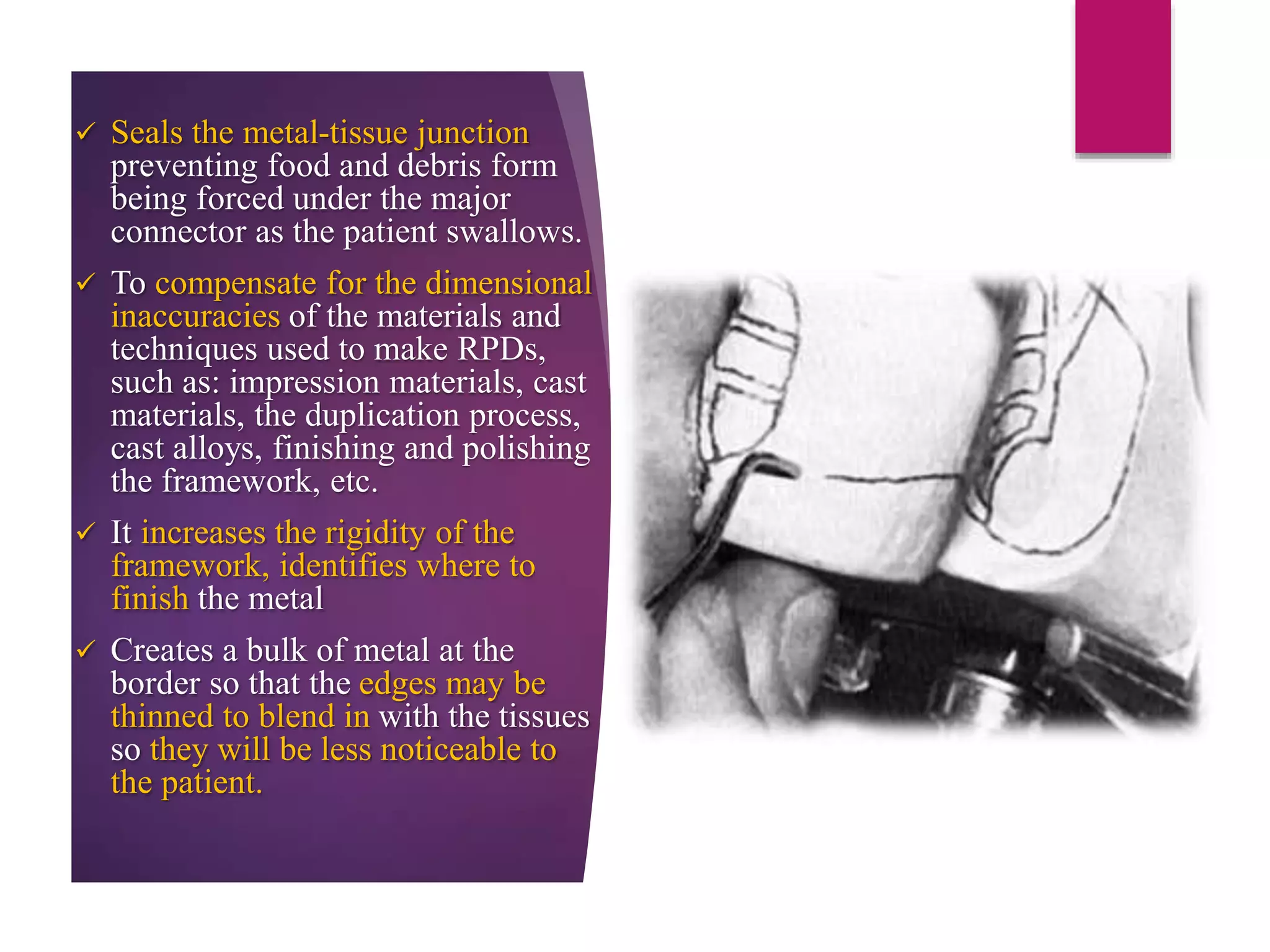 Maxillary & Mandibular Major Connectors.pptx