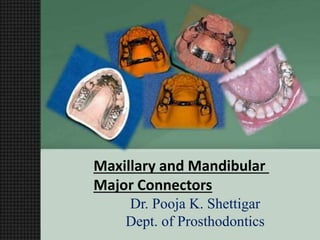 Maxillary & Mandibular Major Connectors.pptx