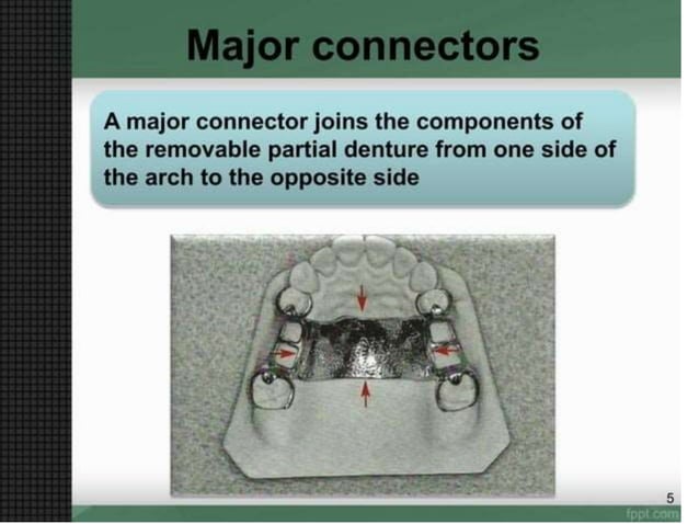 Maxillary & Mandibular Major Connectors.pptx