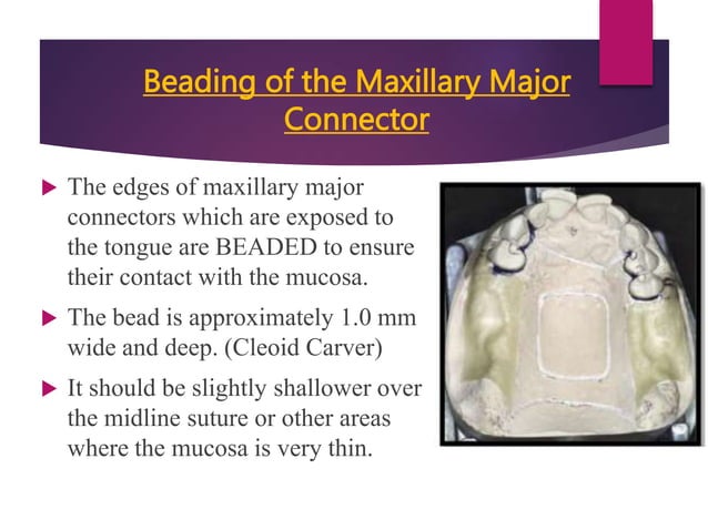 Maxillary & Mandibular Major Connectors.pptx