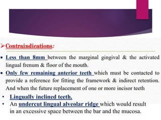 Maxillary & Mandibular Major Connectors.pptx