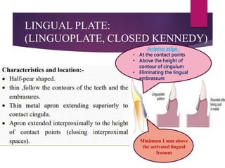 Maxillary & Mandibular Major Connectors.pptx