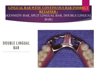 Maxillary & Mandibular Major Connectors.pptx