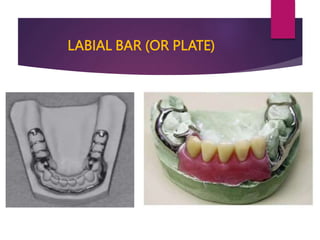 Maxillary & Mandibular Major Connectors.pptx