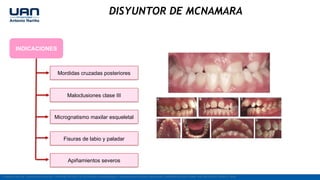 Seminario_de_Quadhelix__BiHelix_y_hyrax.pptx