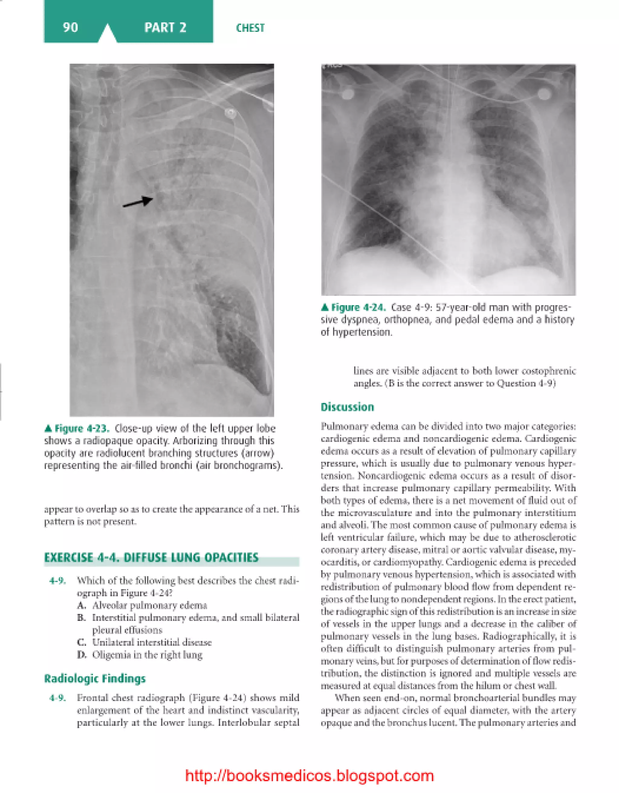 Basic radiology, 2nd ed. | PDF