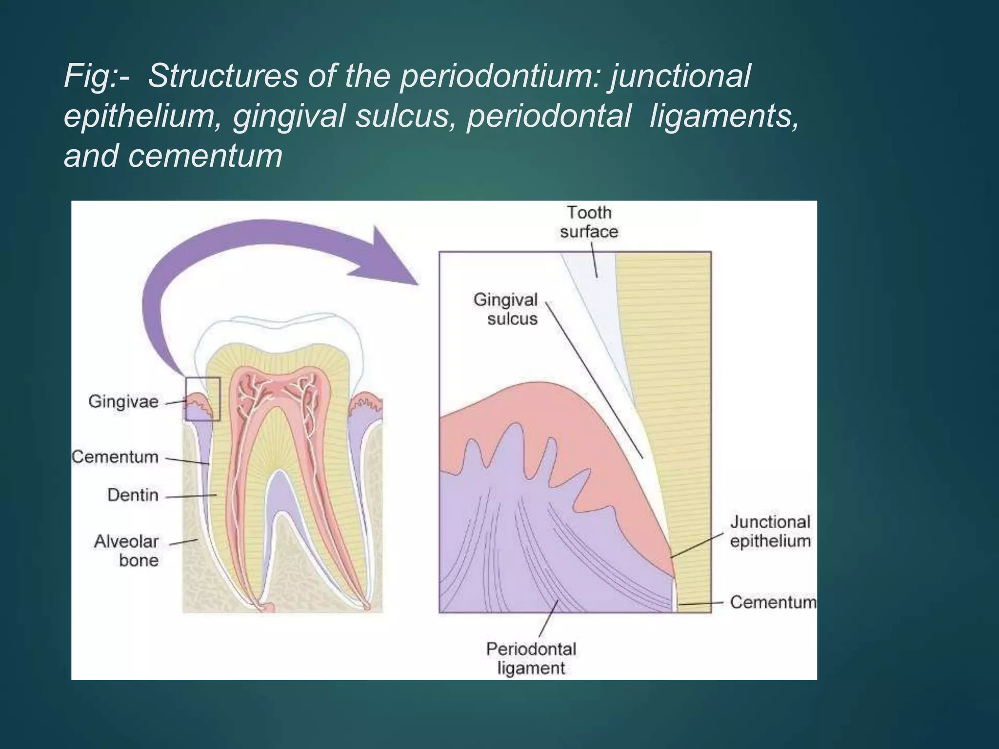 Gingivitis Vs Periodontitis | PPTX