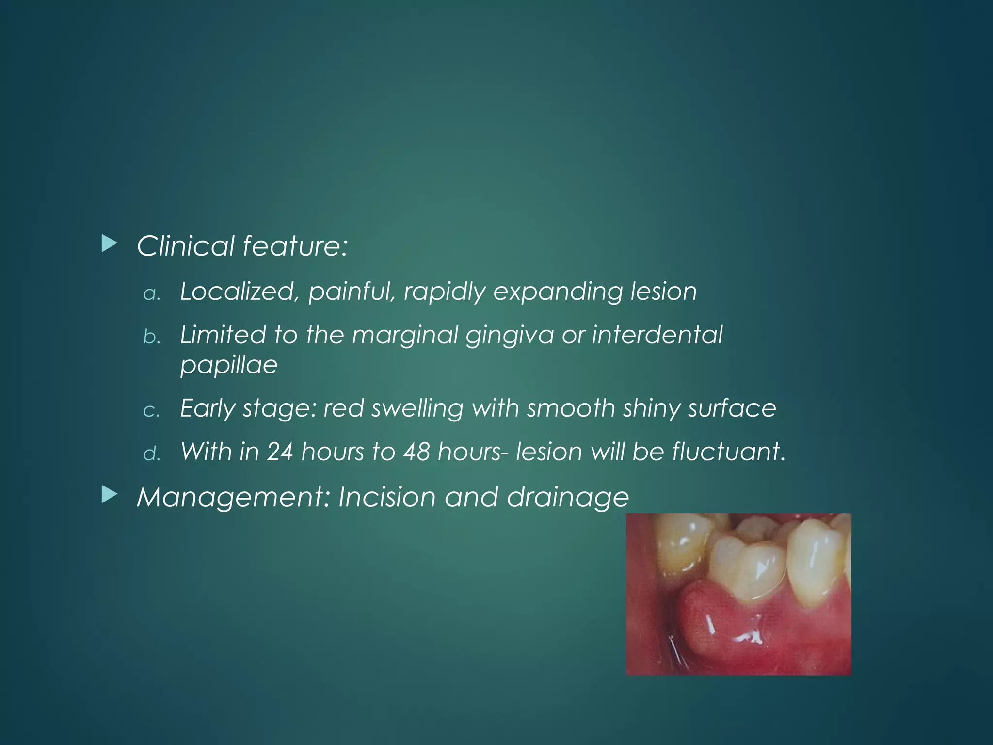 gingival and periodontal diseases | PPT