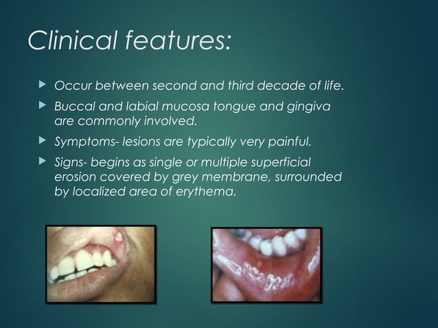 Gingival And Periodontal Diseases Ppt Dental Health Diseases And