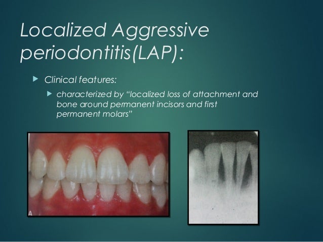 gingival and periodontal diseases