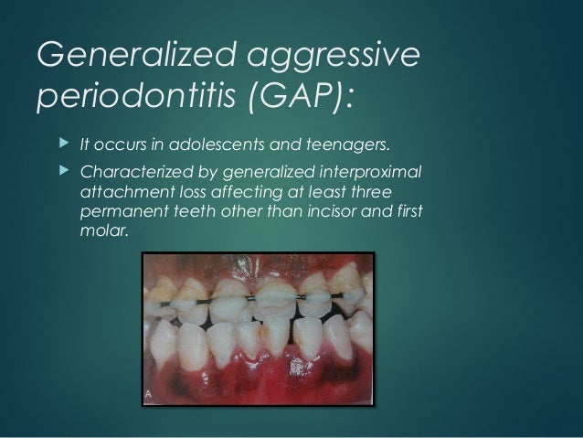 gingival and periodontal diseases