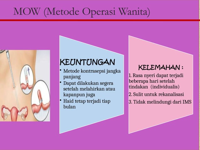 Metode Pemilihan KB Jangka Panjang..pptx