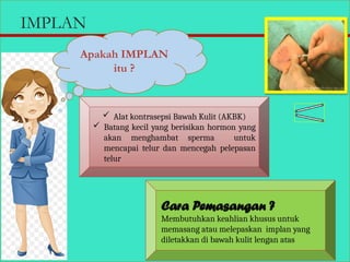 Metode Pemilihan KB Jangka Panjang..pptx