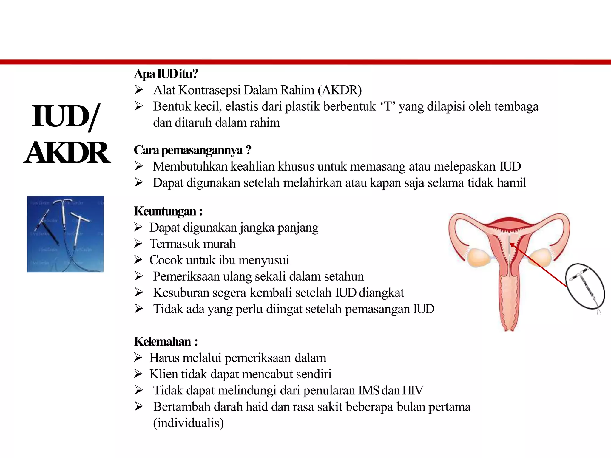 MKJP-METODE-KONTRASEPSI-pptx.pptx