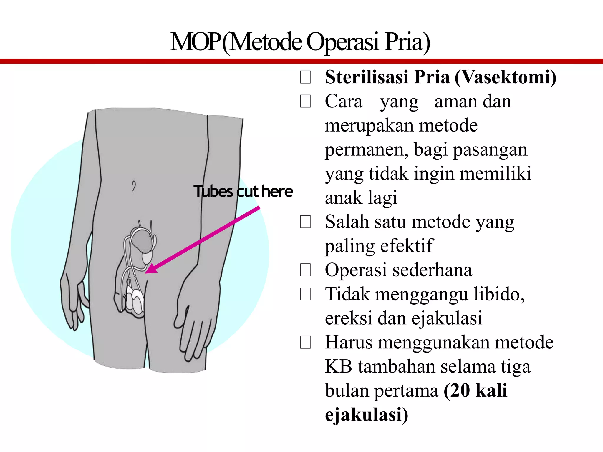 MKJP-METODE-KONTRASEPSI-pptx.pptx