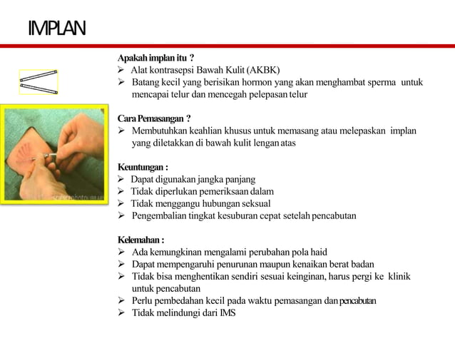 MKJP-METODE-KONTRASEPSI-pptx.pptx