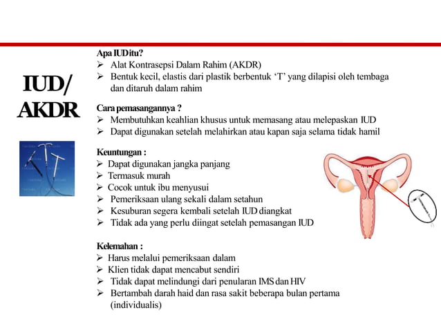 MKJP-METODE-KONTRASEPSI-pptx.pptx