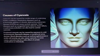 Physiology of cyanosis presentation.pptx