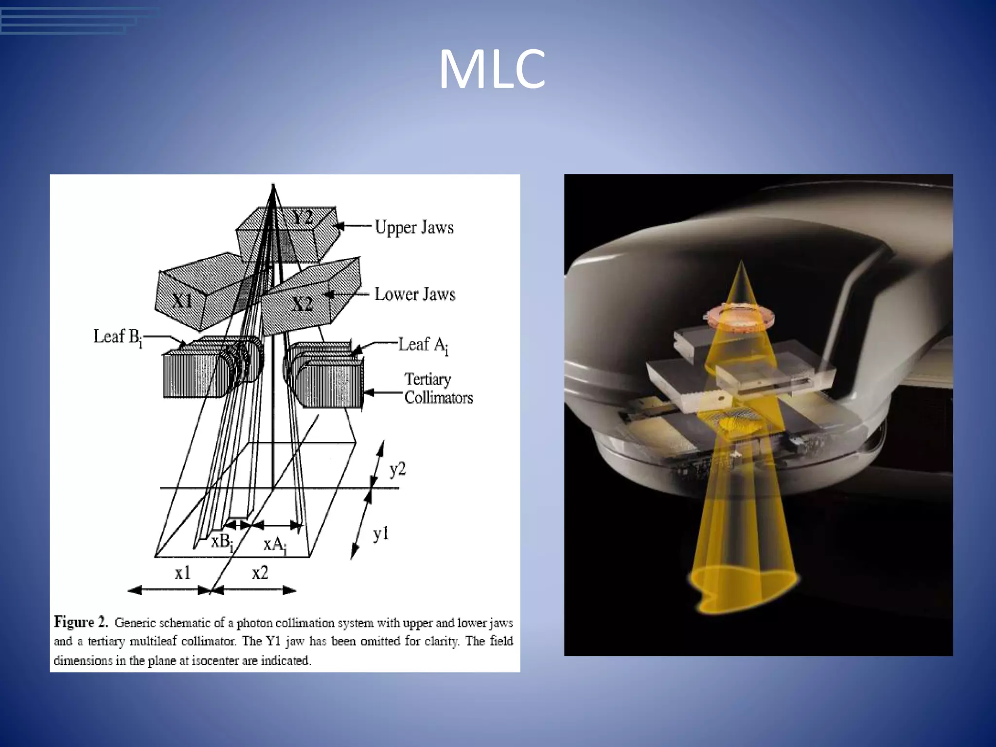 Multileaf Collimator | PPTX