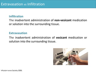 Mld and extravasation | PDF