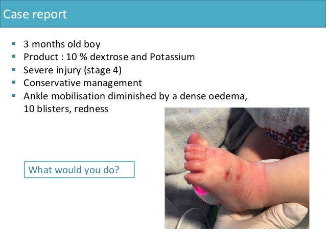 Mld and extravasation