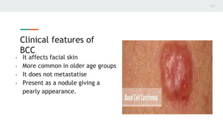 Malignant Lesions in Oral Cavity | PPTX | Bone and Joint Conditions ...