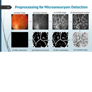 ML edddddddddddddddddddddddddxduated detection.pptx