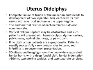 Müllerian Duct Anomalies.pptx