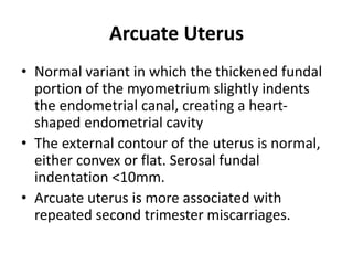 Müllerian Duct Anomalies.pptx