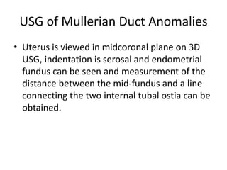 Müllerian Duct Anomalies.pptx