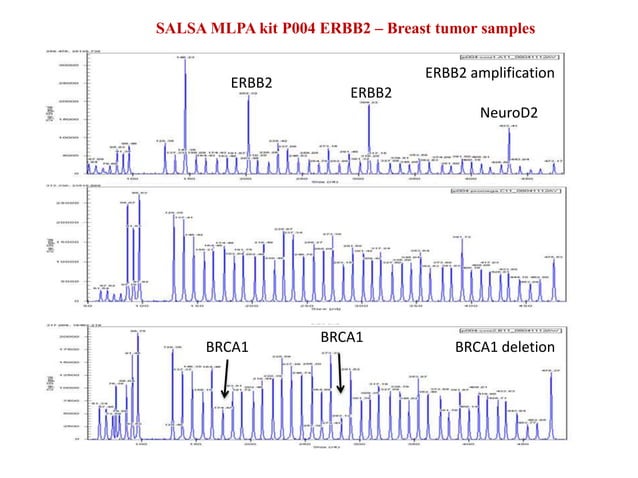 Mlpa (Multipleks PCR) | PPT