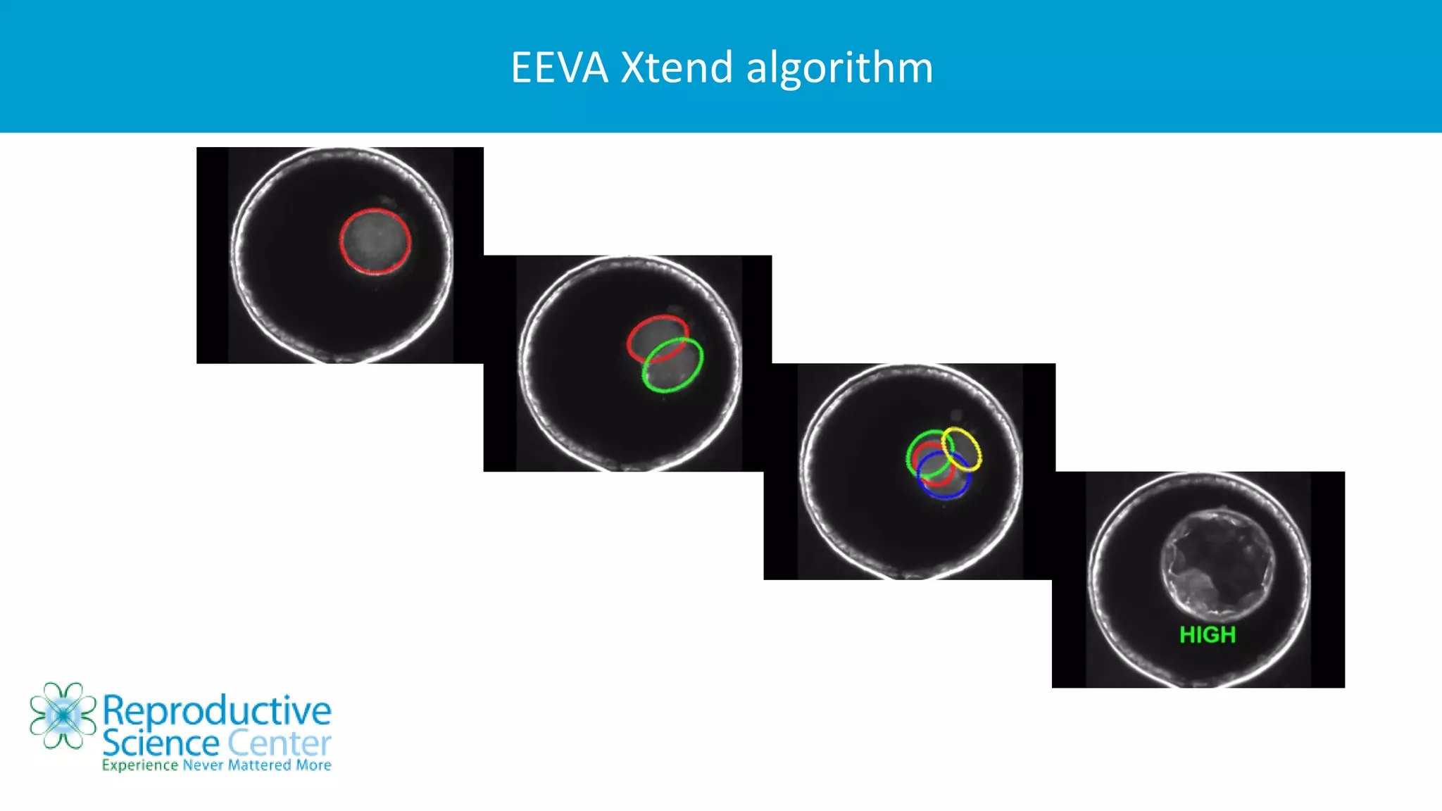 Machine Learning in Reproductive Science: Human Embryo Selection and ...