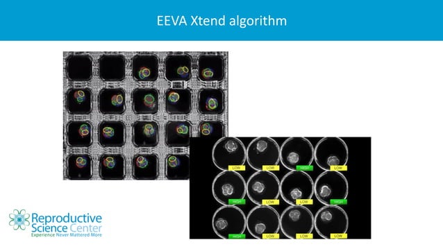 Machine Learning in Reproductive Science: Human Embryo Selection and ...