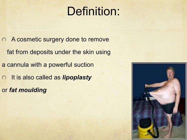 Anesthesia management for Mega liposuction. | PPT