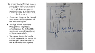 ML stability of the patient with through knee Prosthesis.pptx