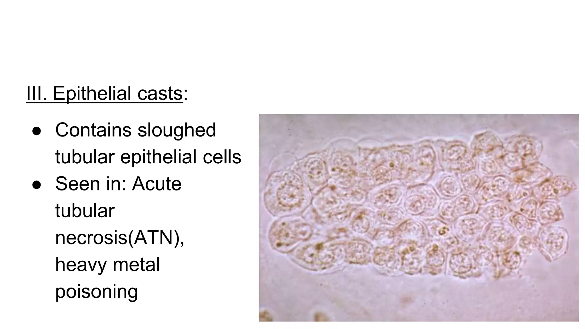 Urine: Microscopic examination - Pathology - MLT, ATOT, RDT | PPTX