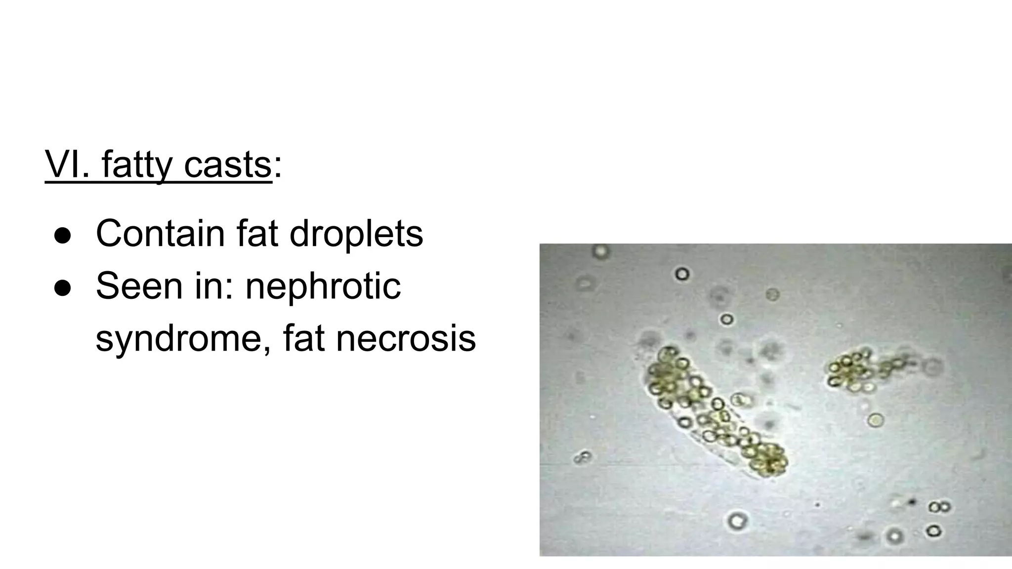 Urine: Microscopic examination - Pathology - MLT, ATOT, RDT | PPTX