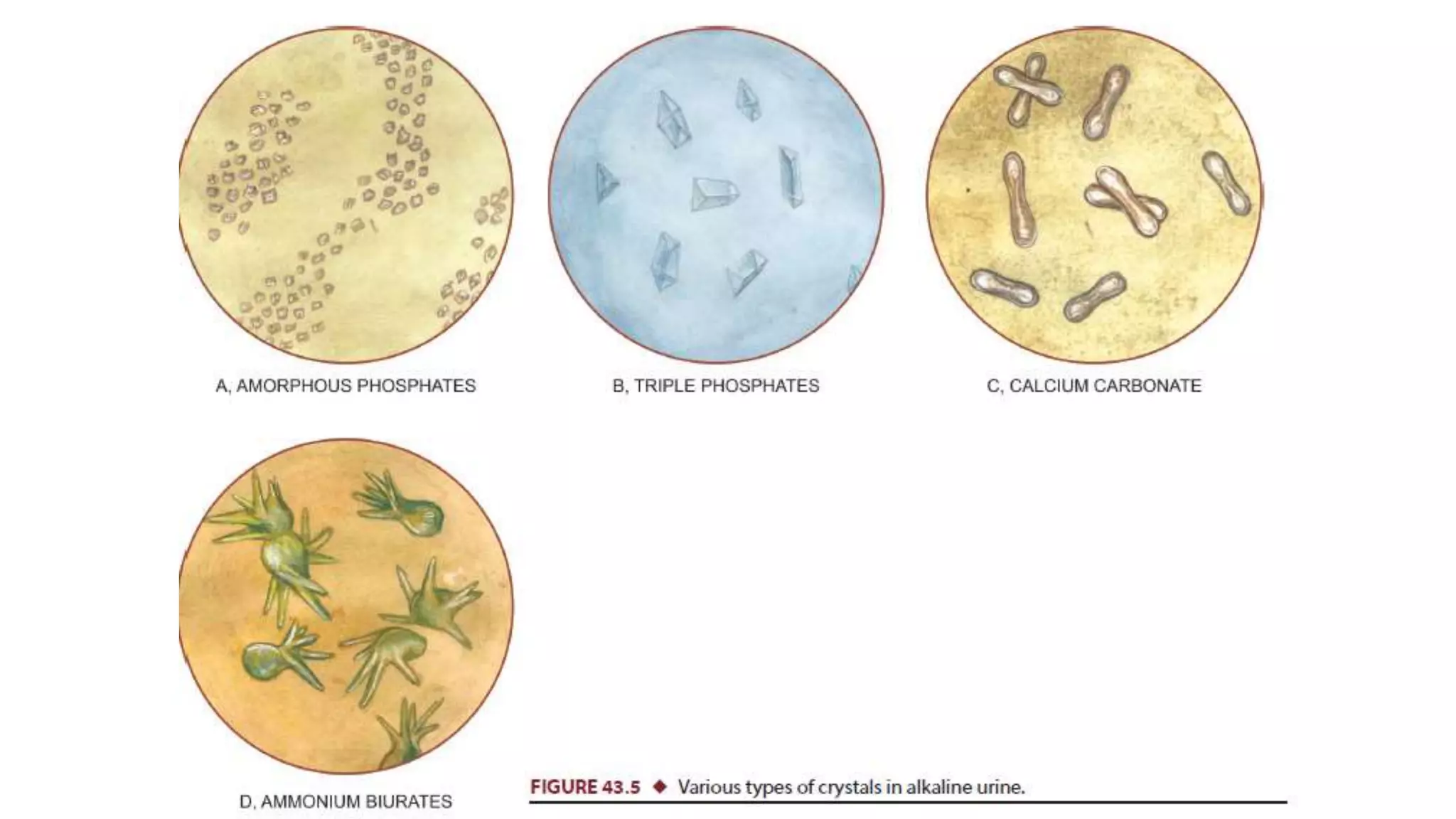 Urine: Microscopic examination - Pathology - MLT, ATOT, RDT | PPTX