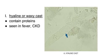 Urine: Microscopic examination - Pathology - MLT, ATOT, RDT | PPTX