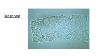 Urine: Microscopic examination - Pathology - MLT, ATOT, RDT | PPTX ...