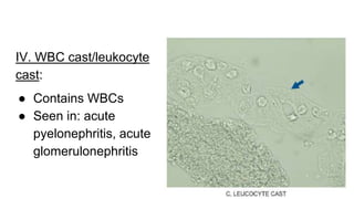 Urine: Microscopic examination - Pathology - MLT, ATOT, RDT | PPTX