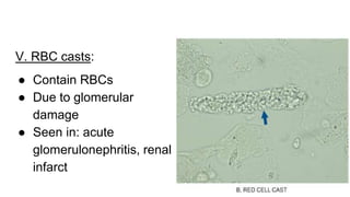 Urine: Microscopic examination - Pathology - MLT, ATOT, RDT | PPTX