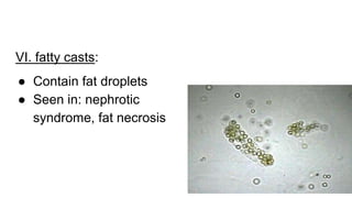 Urine: Microscopic examination - Pathology - MLT, ATOT, RDT | PPTX