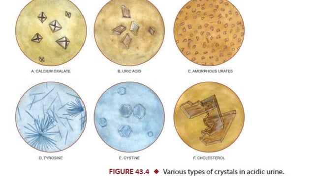 Urine: Microscopic examination - Pathology - MLT, ATOT, RDT | PPTX ...