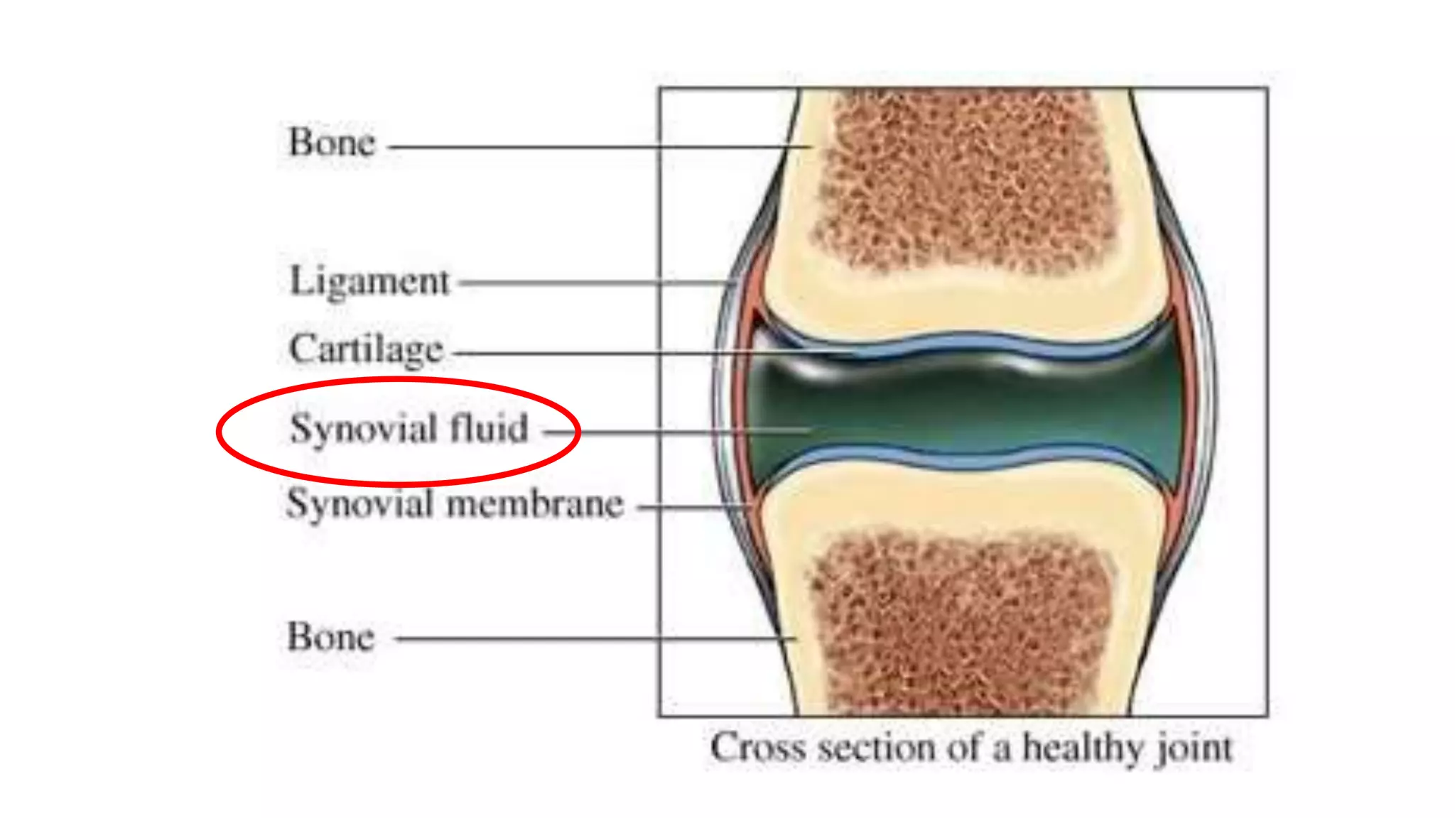 Examination of Body Fluids - Pathology - MLT, ATOT, RDT | PPTX
