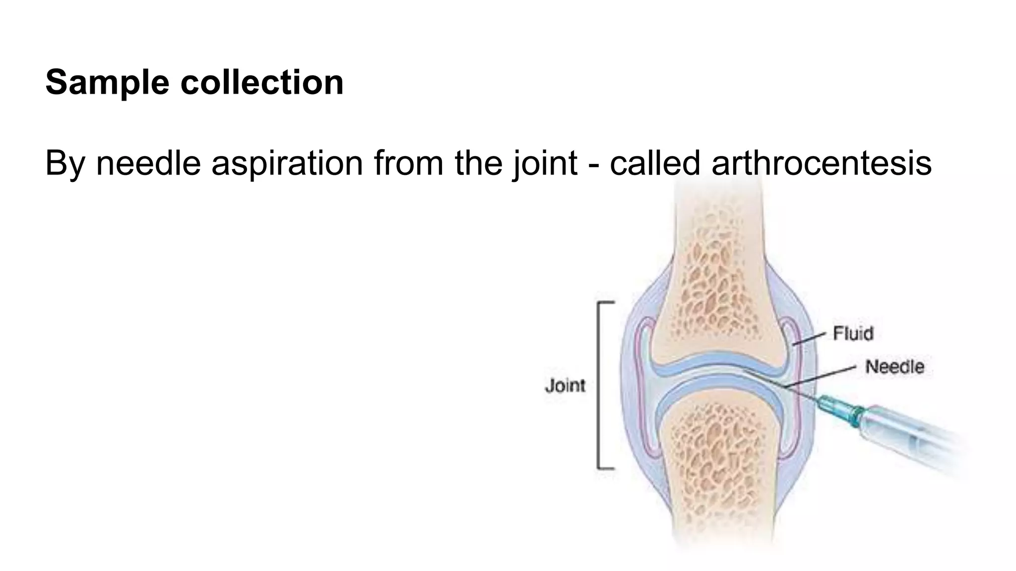 Examination of Body Fluids - Pathology - MLT, ATOT, RDT | PPTX