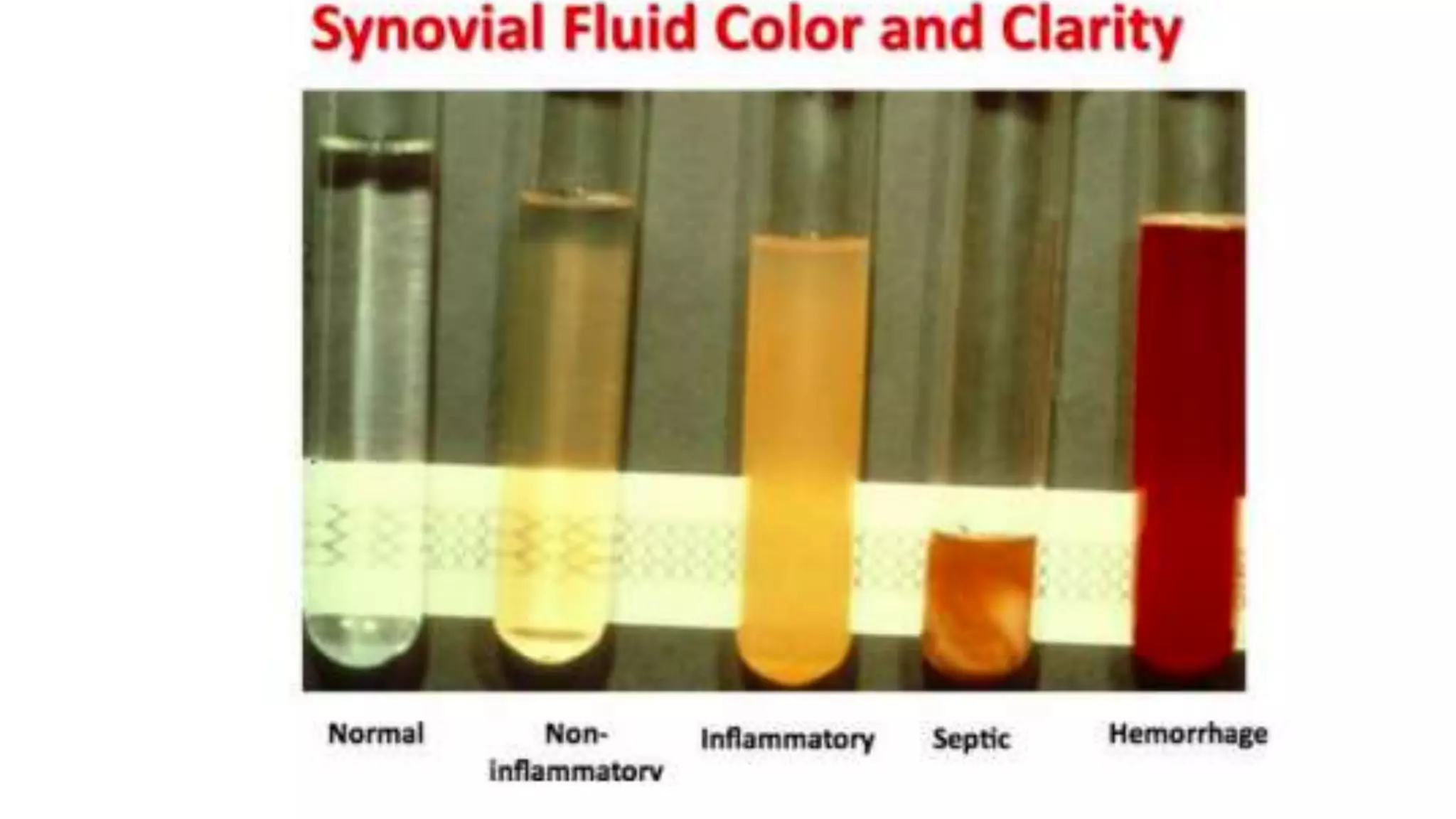 Examination of Body Fluids - Pathology - MLT, ATOT, RDT | PPTX