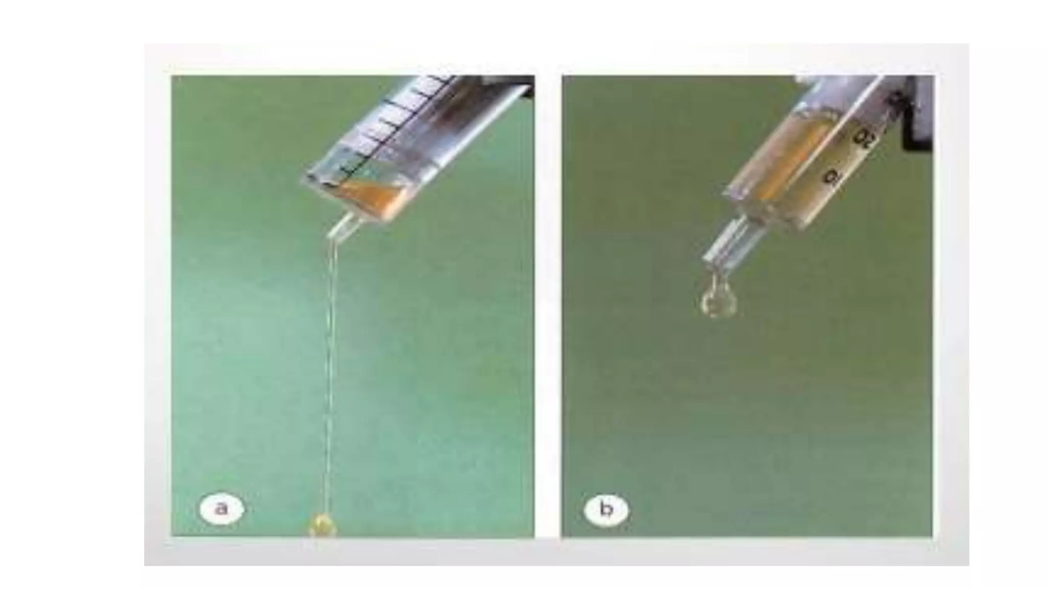 Examination of Body Fluids - Pathology - MLT, ATOT, RDT | PPTX